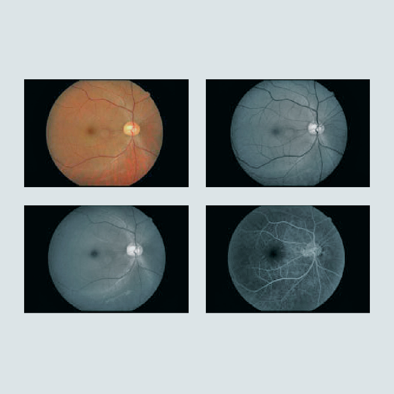 Apramed - RETINÓGRAFO CANON MODELO CX1